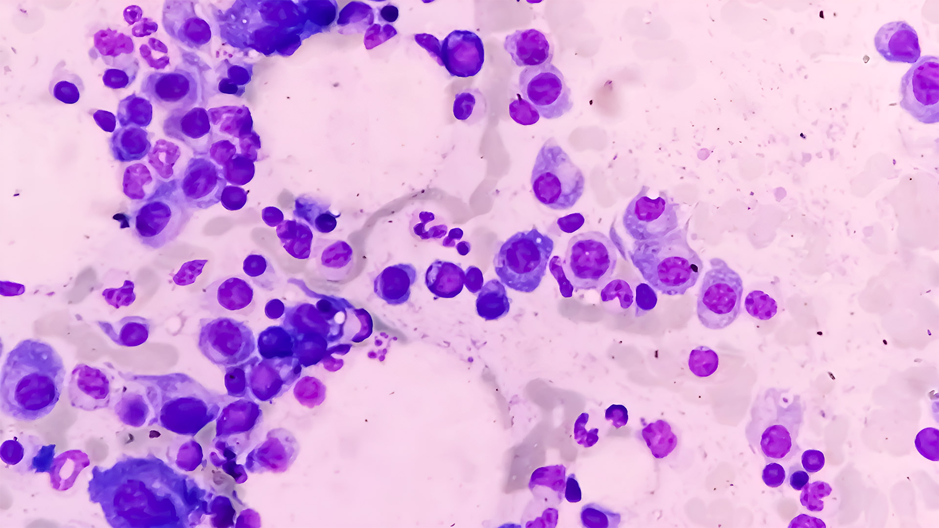 Drug Delivery Summit 2026 | Injections Transform Cancer Care